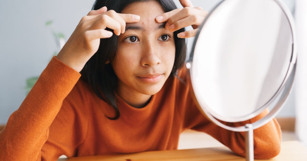 Pubers met puistjes: stappenplan om acne te lijf te gaan