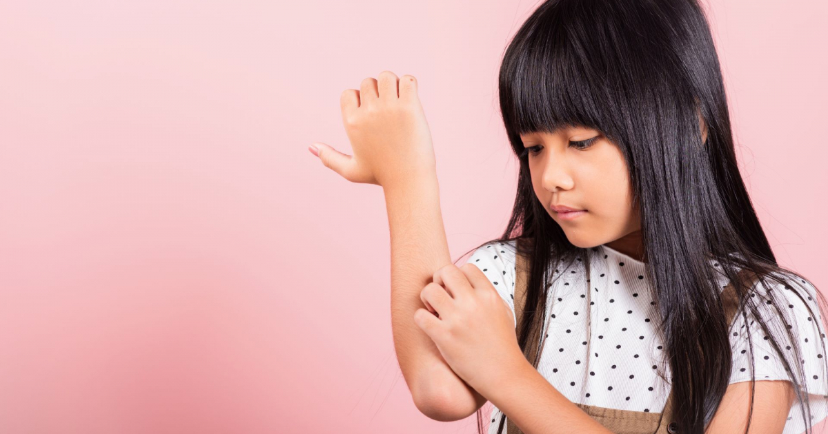 Alles over netelroos bij je kind: oorzaken, symptomen & behandelingen